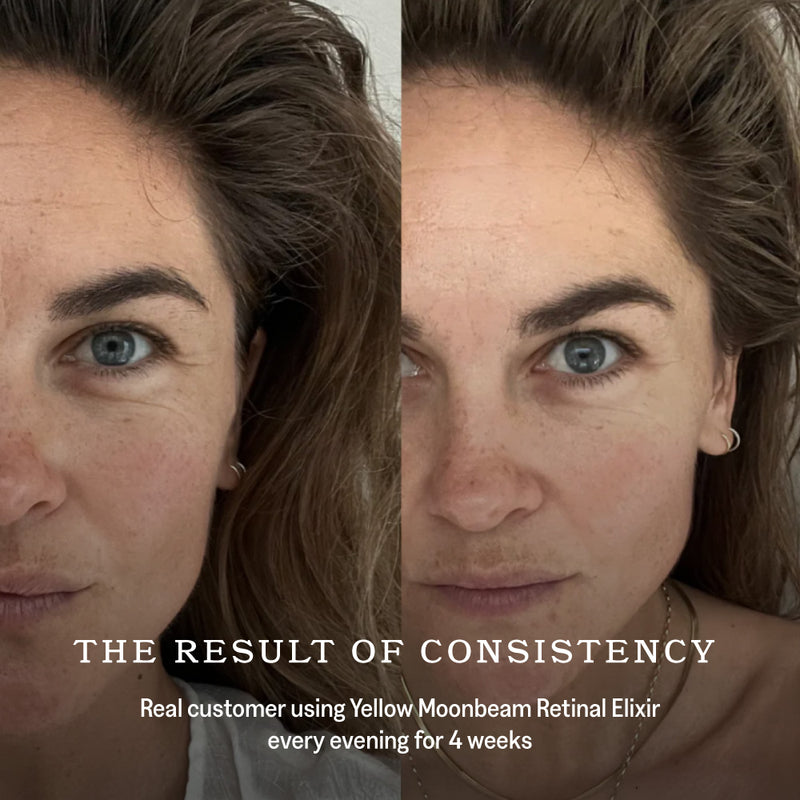 Yellow Moonbeam Retinal Elixir | Vitamin A Serum | RAAIE Skincare